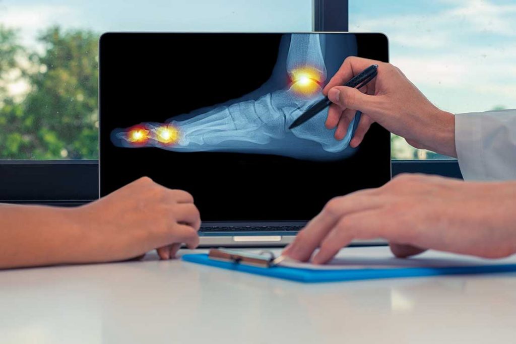 Cartiva Implant – Shield Justice Online